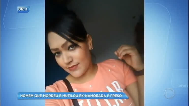 Homem Acusado De Arrancar Orelha De Ex Namorada Com Os Dentes é Preso